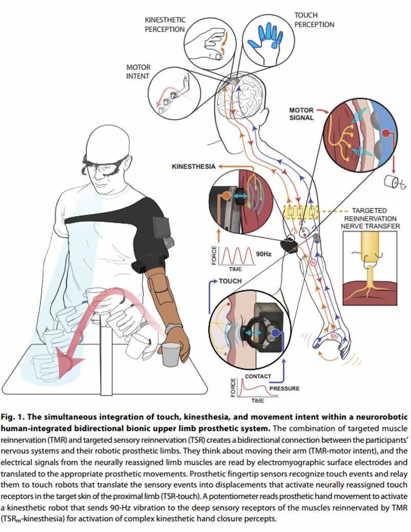 Amputees Feel Touch Anew Thanks To New Bionic Arm Owners Magazine